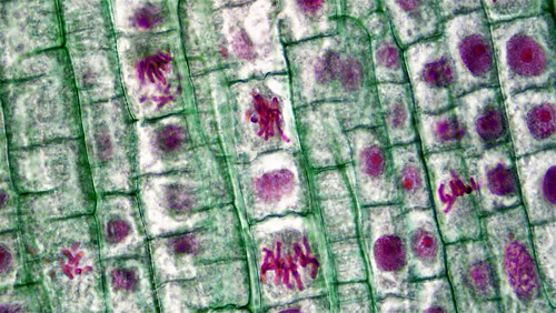 Mitotic Stages in Apical Meristem of Allium Root Tip | Flickr