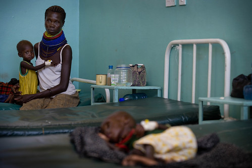 Honger in de Hoorn van Afrika | Severely malnourished childr… | Flickr