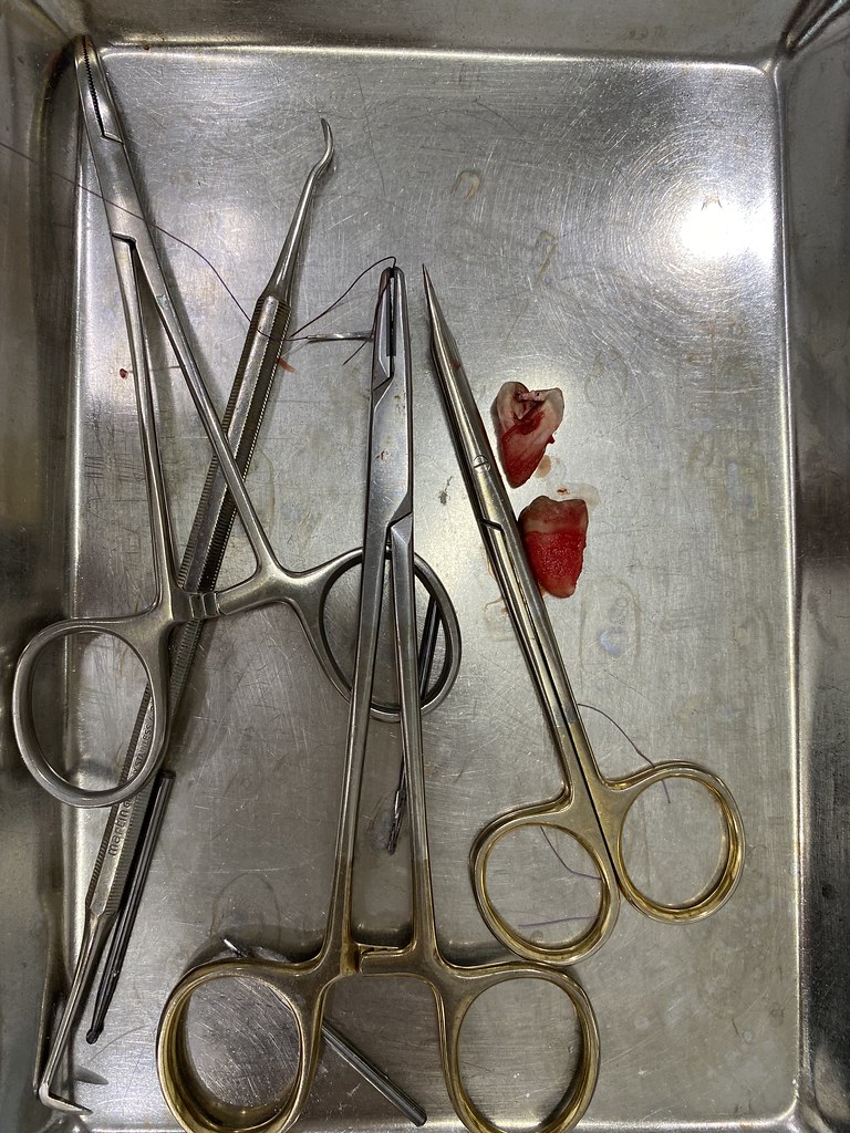 Left Lower Wisdom Tooth, Poon Dental Surgery | chineu | Flickr