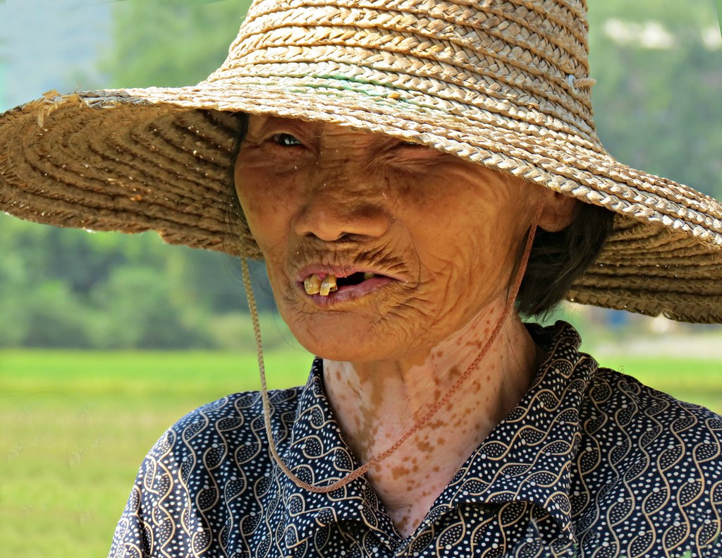 Chinese Stereotype Buck Teeth